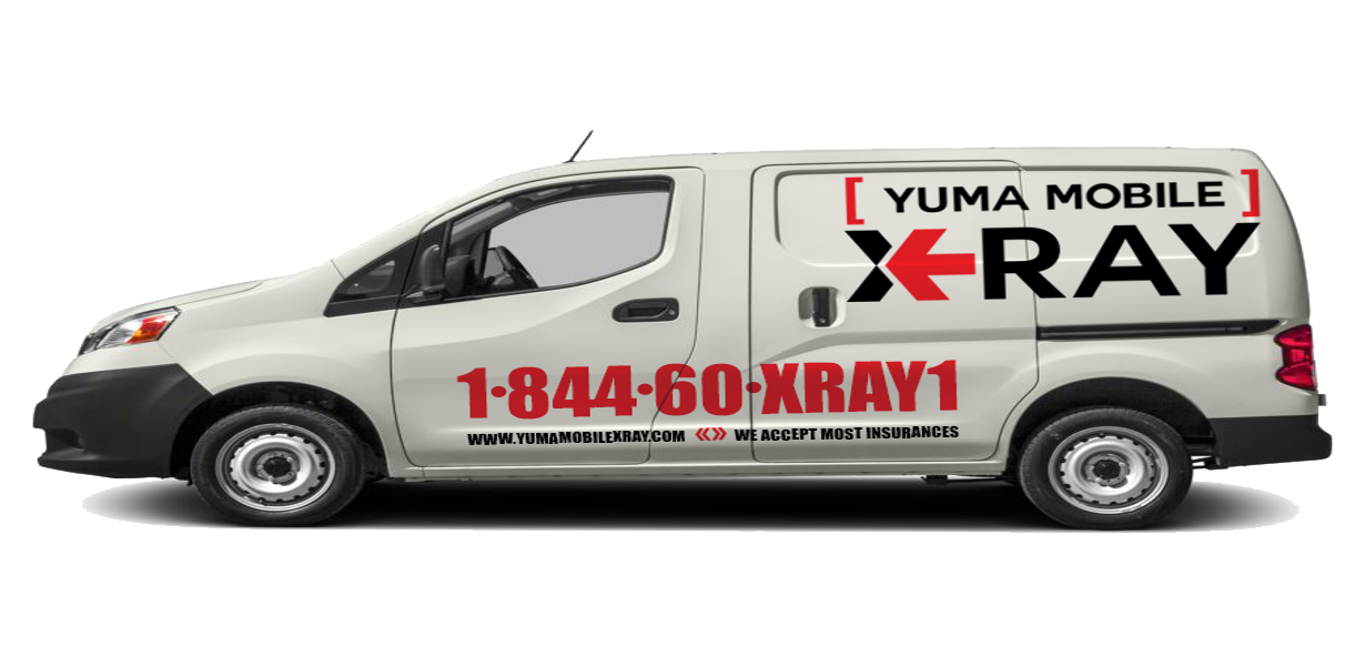 yuma-mobile-xray-van-hero – YUMA MOBILE X-RAY SERVICE